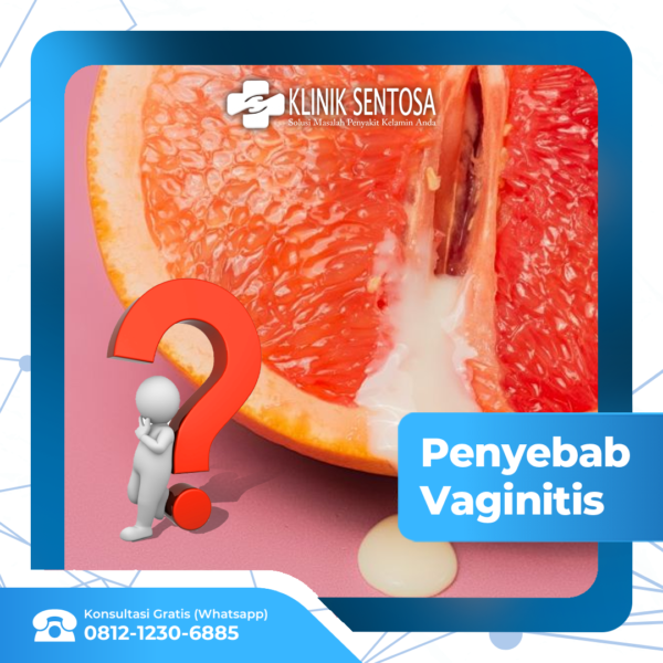 Ketahui Penyebab Vaginitis (Radang Vagina) – Klinik Utama Apollo