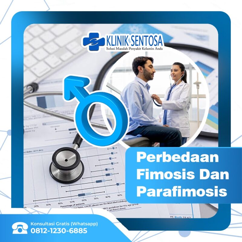 Fimosis dan Parafimosis Apakah Perbedaan Keduanya? – Klinik Utama Apollo