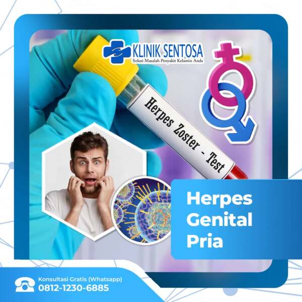 Herpes Genital Pada Pria Memangnya Bisa? – Klinik Utama Apollo