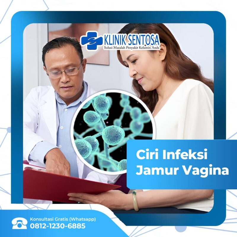 Ciri-Ciri Infeksi Jamur Vagina yang Harus Diketahui – Klinik Utama Apollo