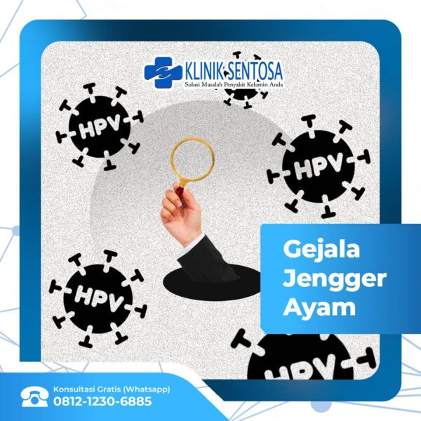 Kenali Gejala Jengger Ayam Pada Wanita – Klinik Utama Apollo