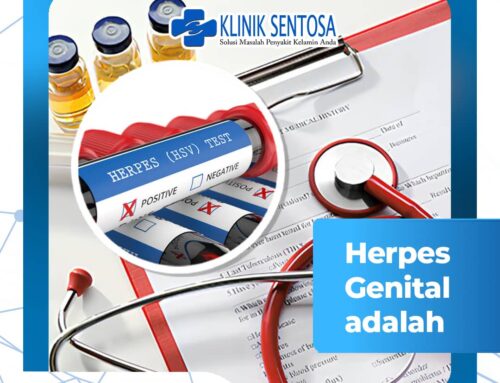 Sifilis Sekunder Apakah Berbahaya? – Klinik Utama Sentosa