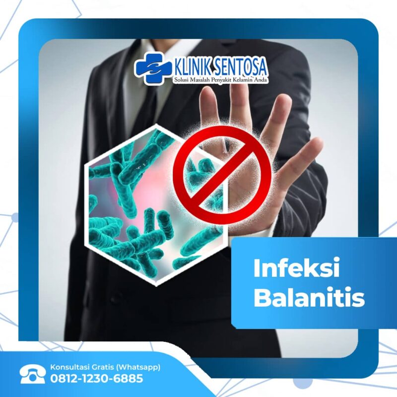Infeksi Kulup: Waspada Terhadap Balanitis yang Mengganggu – Klinik ...