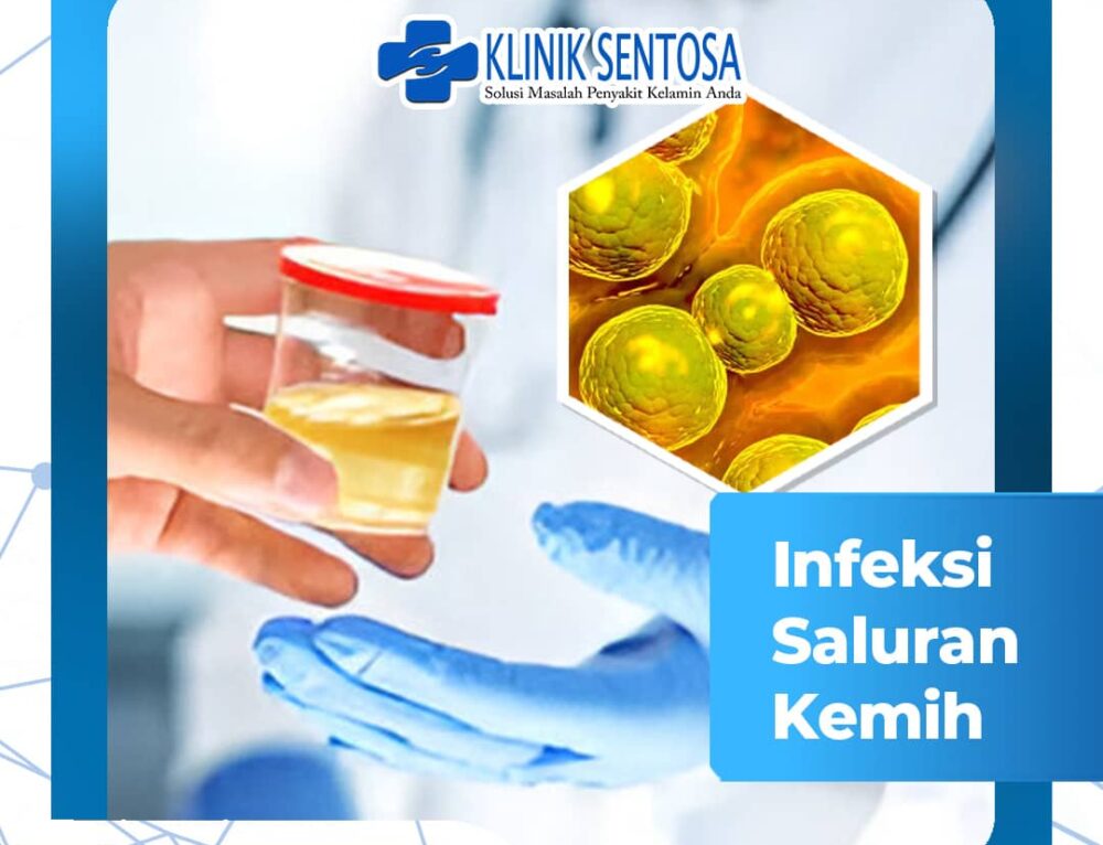 Kenali Penyebab dan Cara Mengobati Keputihan Abnormal