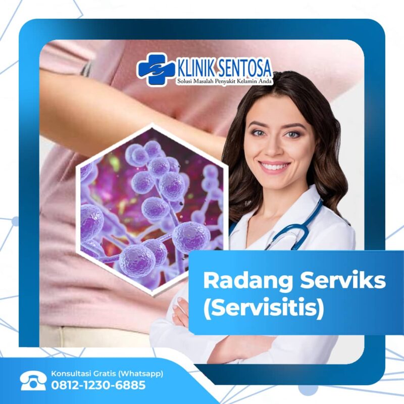 Radang Serviks (Servisitis): Pahami Gejala dan Cegah Komplikasi ...