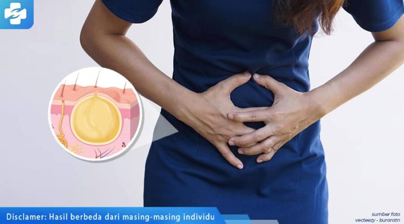 Bartholinitis Benarkah Rentan Menyerang Remaja Ini Ulasannya Klinik