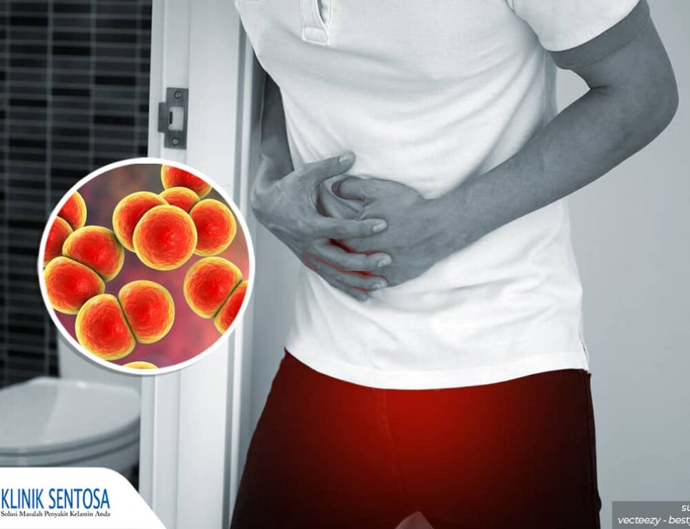 Ternyata Begini, Cara Mengatasi Penyakit Gonore Menurut Dokter – Klinik ...