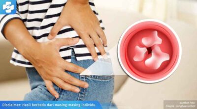 Iritasi pada Miss V, Apa Penyebabnya? Cek Disini Yuk! – Klinik Utama Apollo