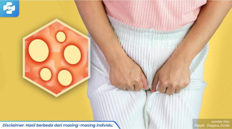 Infeksi Sifilis Parah, Kenali dan Jangan Tunda Pengobatan! – Klinik ...